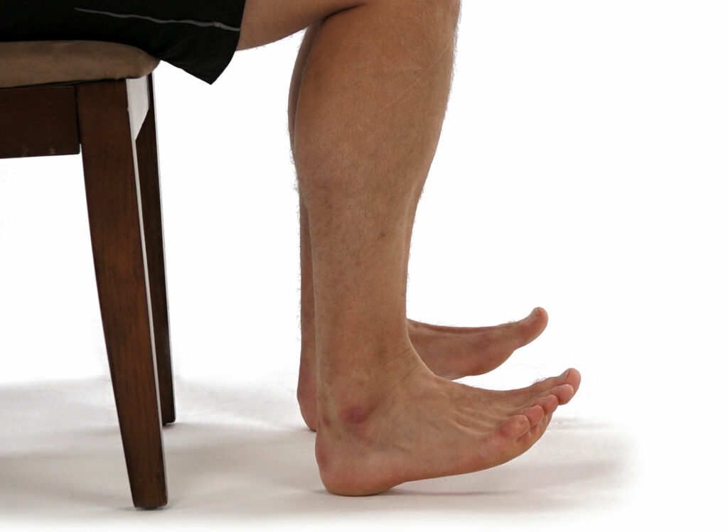 Plantar Fasciitis | Hull University Teaching Hospitals NHS Trust