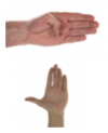 Soft Tissue Injury: Wrist and Hand | Hull University Teaching Hospitals ...