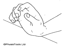 Soft Tissue Injury: Wrist and Hand | Hull University Teaching Hospitals ...