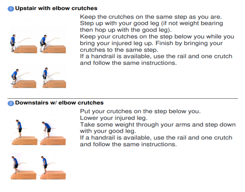Your Guide to: Total Hip Replacements | Hull University Teaching ...