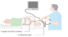 Colonoscopy | Hull University Teaching Hospitals NHS Trust