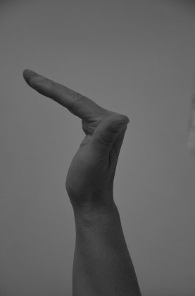 Hand Therapy - Digital Nerve Injuries (PIFU) Information for patients ...