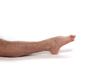 Undisplaced Great Toe Fracture - Advice regarding healing and recovery ...