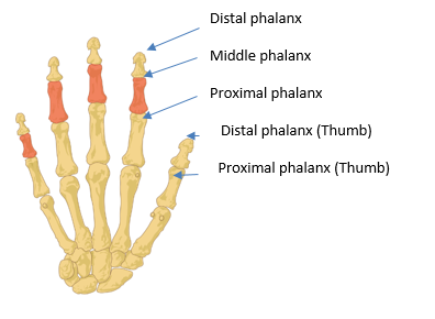 Hand Therapy - Phalangeal fractures of the fingers or thumb | Hull ...