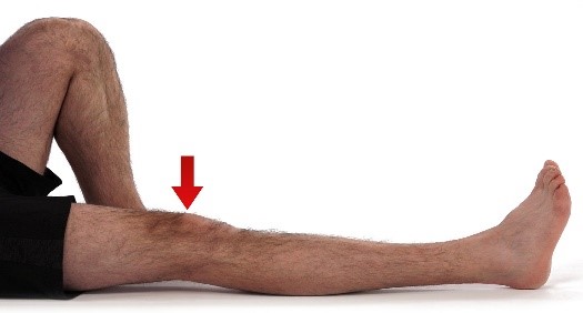 Patella dislocation - Advice regarding healing and recovery | Hull ...