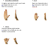 Hand Therapy - Mallet Injury of the Finger (PIFU) | Hull University ...