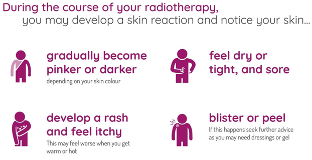 Radiotherapy Skin Reactions | Hull University Teaching Hospitals NHS Trust