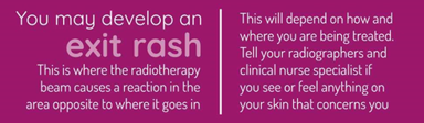 Radiotherapy Skin Reactions | Hull University Teaching Hospitals NHS Trust