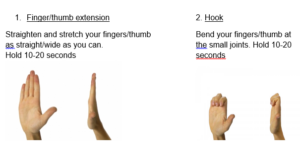 Finger and Thumb Interphalangeal Joint Dislocation or Thumb Metacarpal ...