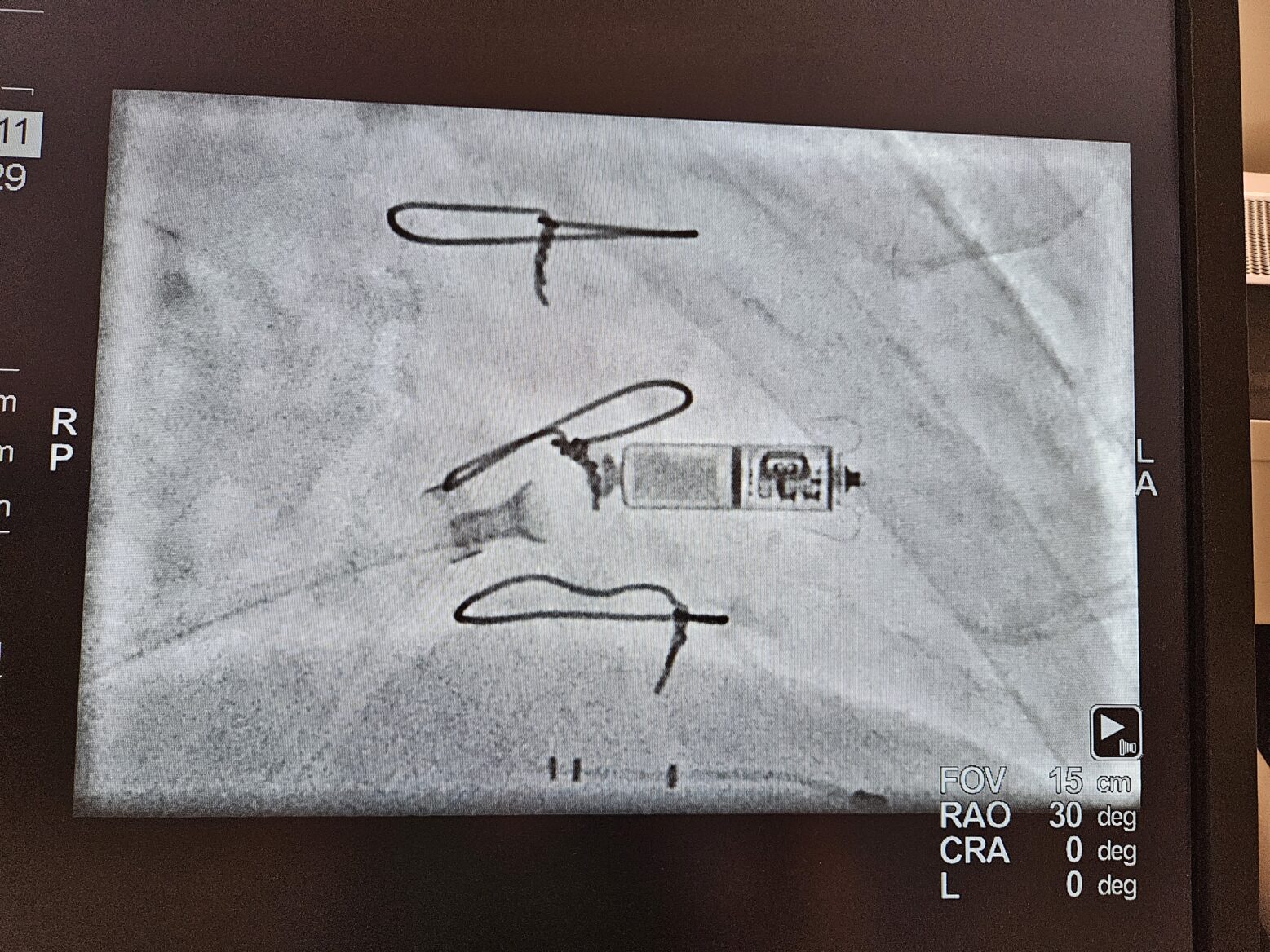 Hull University Teaching Hospitals NHS Trust