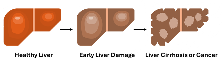 Chronic Hepatitis B infection | Hull University Teaching Hospitals NHS Trust