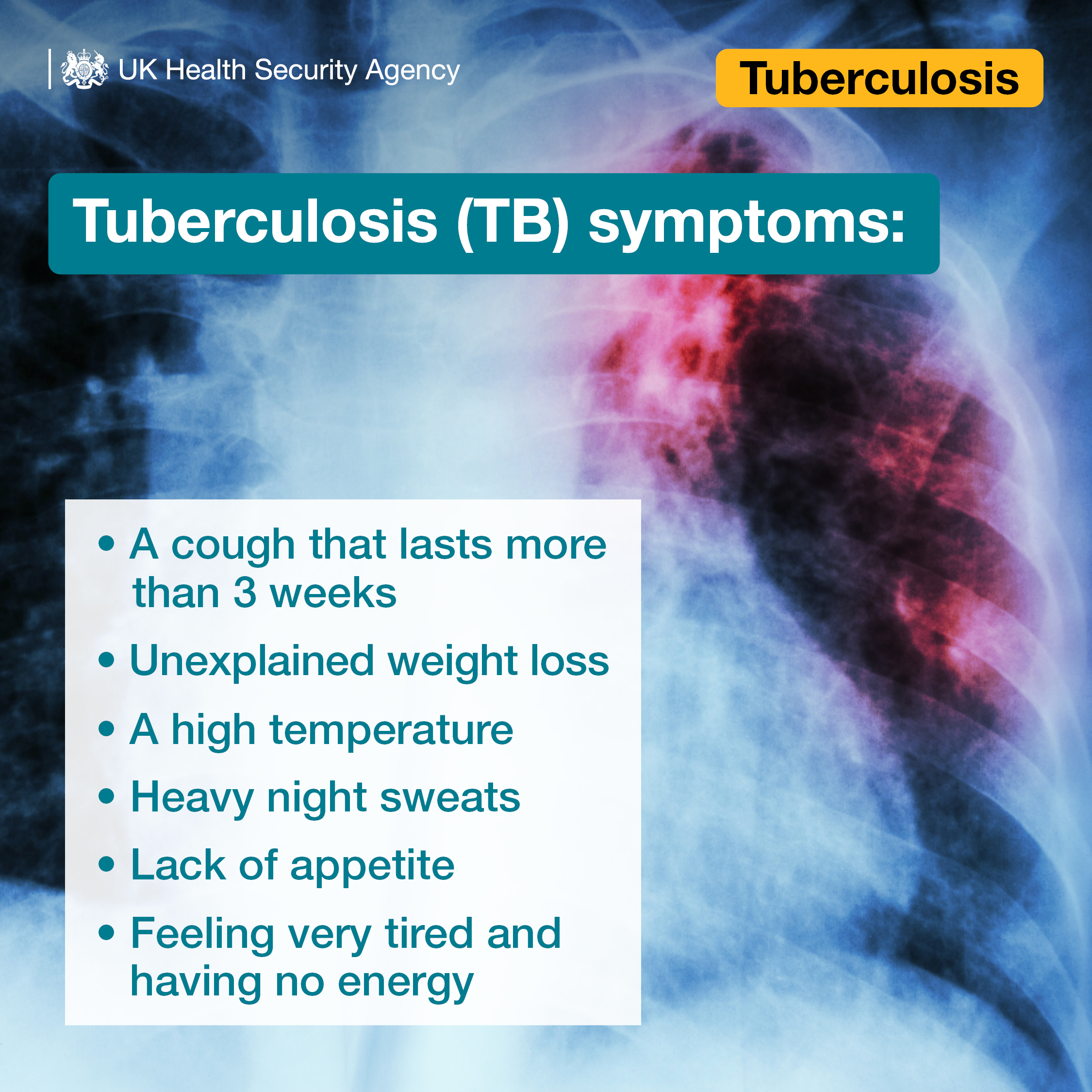 Cases of TB on the rise, says Hull Infectious Diseases Consultant ...